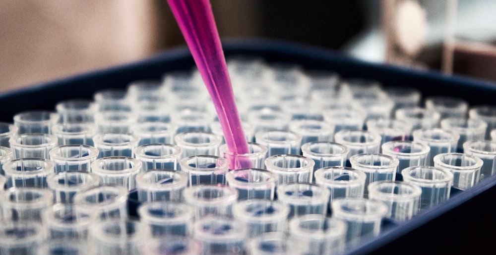 Core Biogenesis ambitionne de réduire le prix des thérapies cellulaires